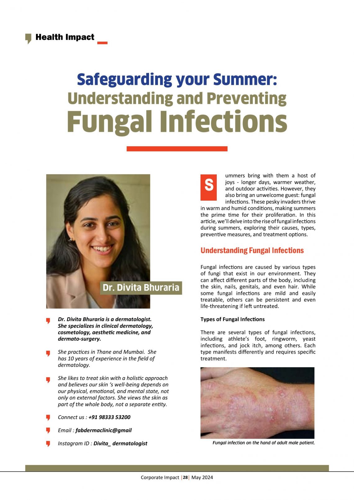 Safeguarding your Summer: Understanding and Preventing Fungal ...